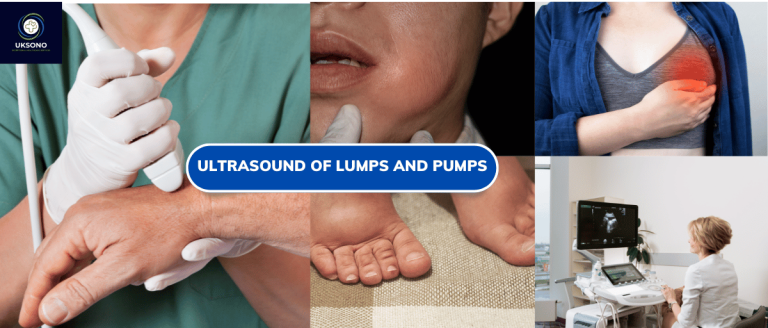 Lump & Bump Scan – UKSONO HEALTHCARE